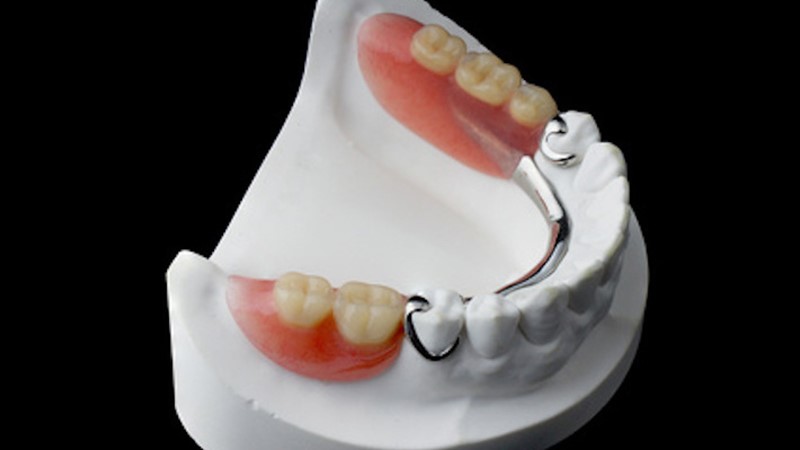 Próteses Dentárias - Dentunes